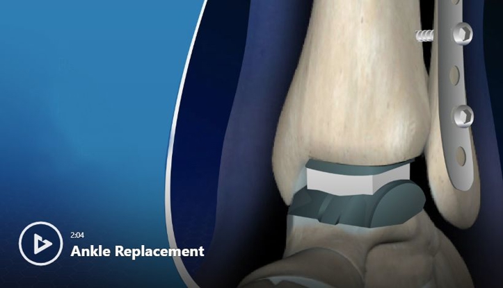 Foot & Ankle Conditions & Treatments | Newport Orthopedic Institute