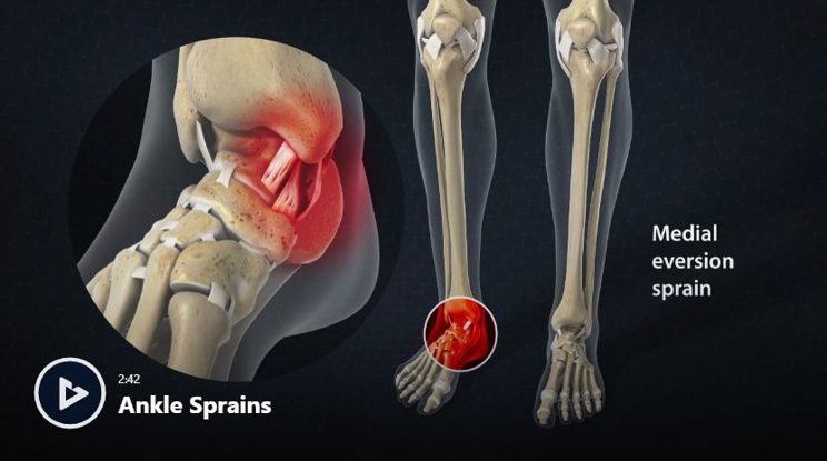 Foot & Ankle Conditions & Treatments | Newport Orthopedic Institute