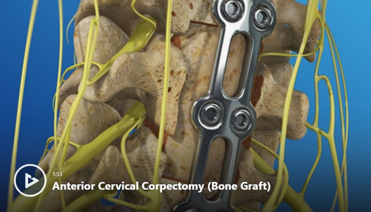 Spine Conditions & Treatments | Orthopedists Newport Beach, CA