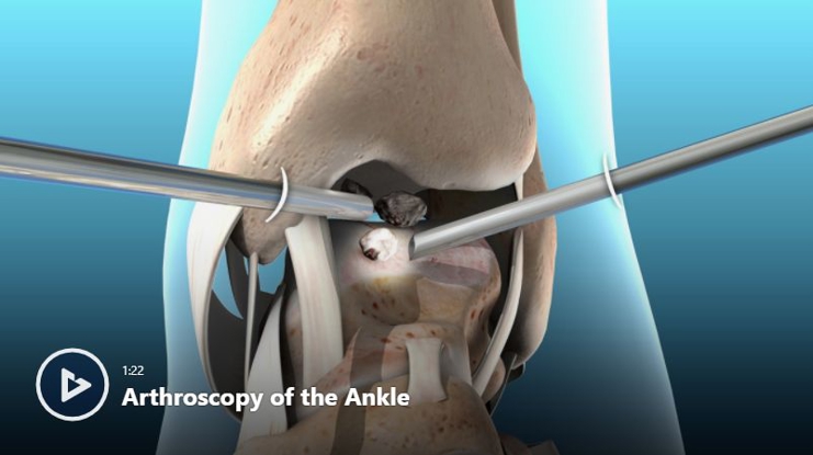 Foot & Ankle Conditions & Treatments | Newport Orthopedic Institute