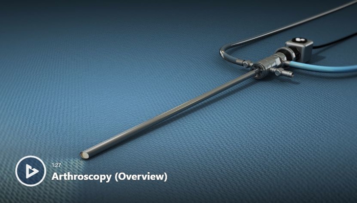 Total Knee Replacement Surgery in Orange County, CA