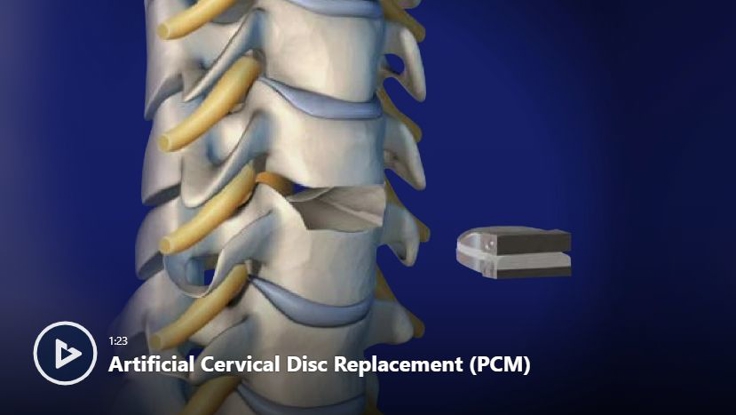 Spine Conditions & Treatments | Orthopedists Newport Beach, CA