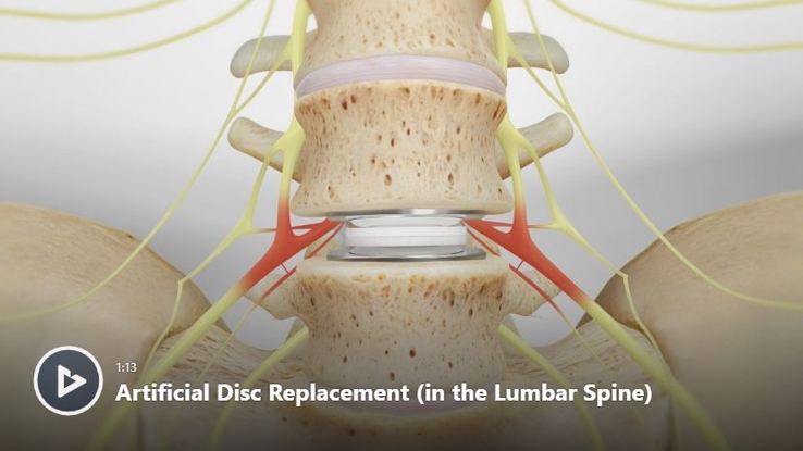Spine Conditions & Treatments | Orthopedists Newport Beach, CA