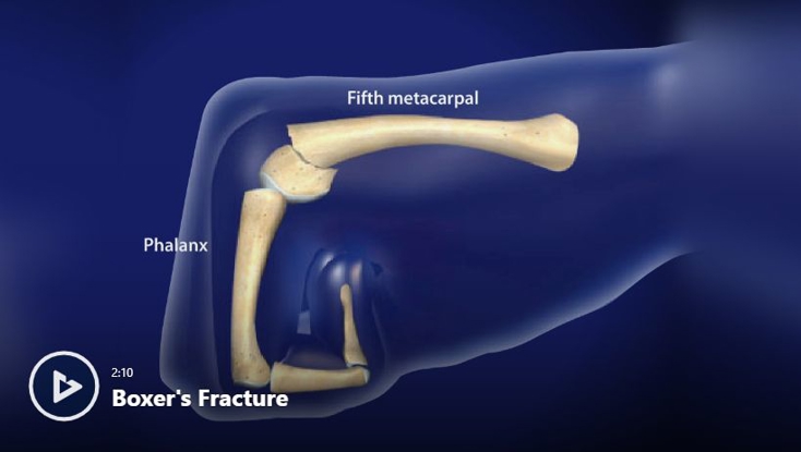 Hand & Wrist Conditions & Treatments | Newport Orthopedic Institute