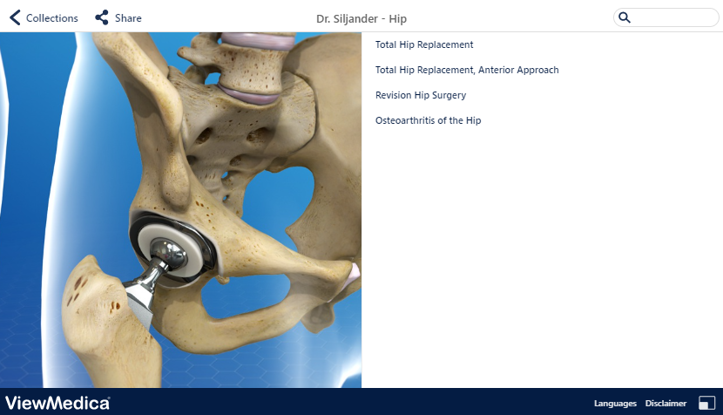 Hip Conditions & Treatments | Orthopedists Newport Beach, CA