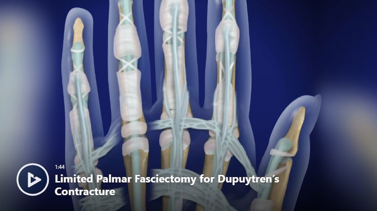 Hand & Wrist Conditions & Treatments Videos | Newport Orthopedic Institute