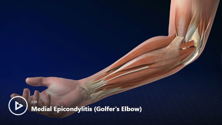 Elbow Conditions & Treatments | Newport Orthopedic Institute