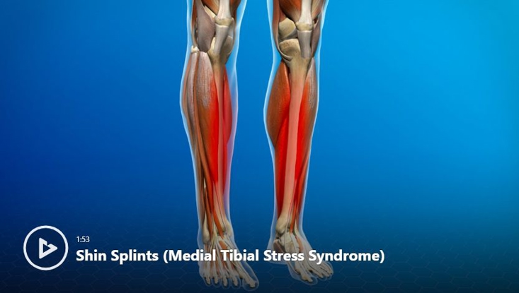 Foot & Ankle Conditions & Treatments Videos | Newport Orthopedic Institute