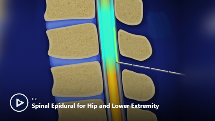 Pain Management Videos | Newport Orthopedic Institute