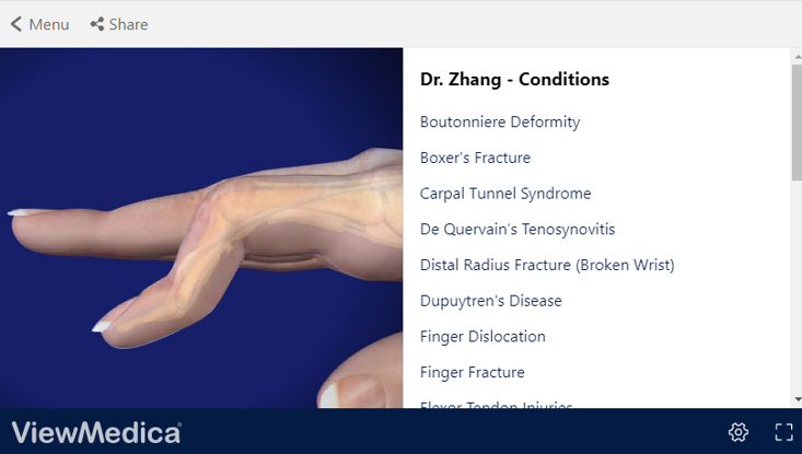 Joanne Y Zhang Mba Md Newport Orthopedic Institute
