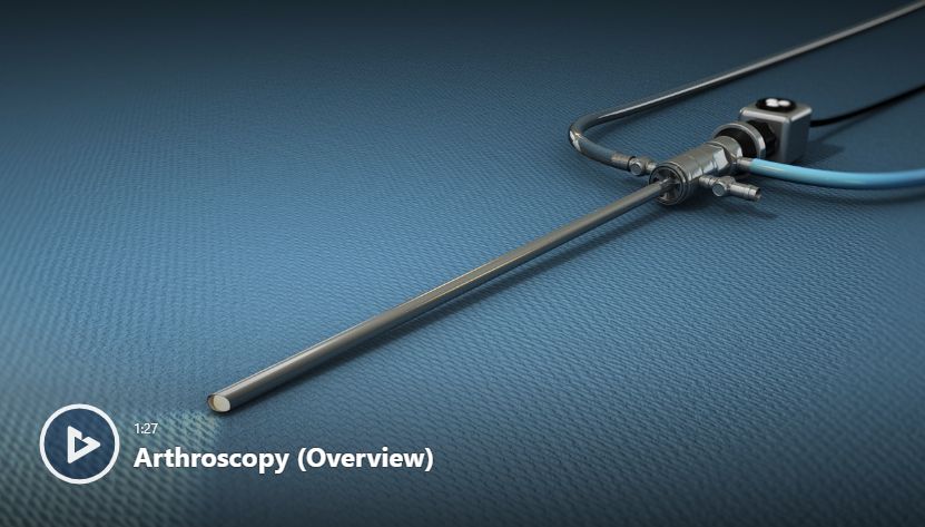 Arthroscopy (Overview) Video | Newport Orthopedic Institute