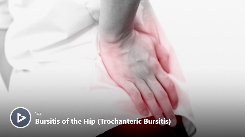 Bursitis of the Hip (Trochanteric Bursitis) Video | Newport Orthopedic ...