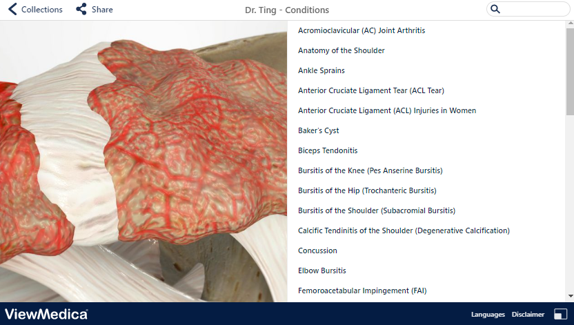 Dr. Ting - Conditions Video | Newport Orthopedic Institute