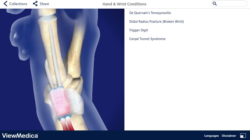Hand & Wrist Conditions Video | Newport Orthopedic Institute