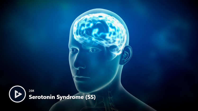 Serotonin Syndrome (SS) Video | Newport Orthopedic Institute