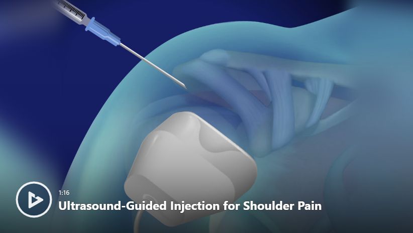Ultrasound-Guided Injection for Shoulder Pain Video | Newport ...